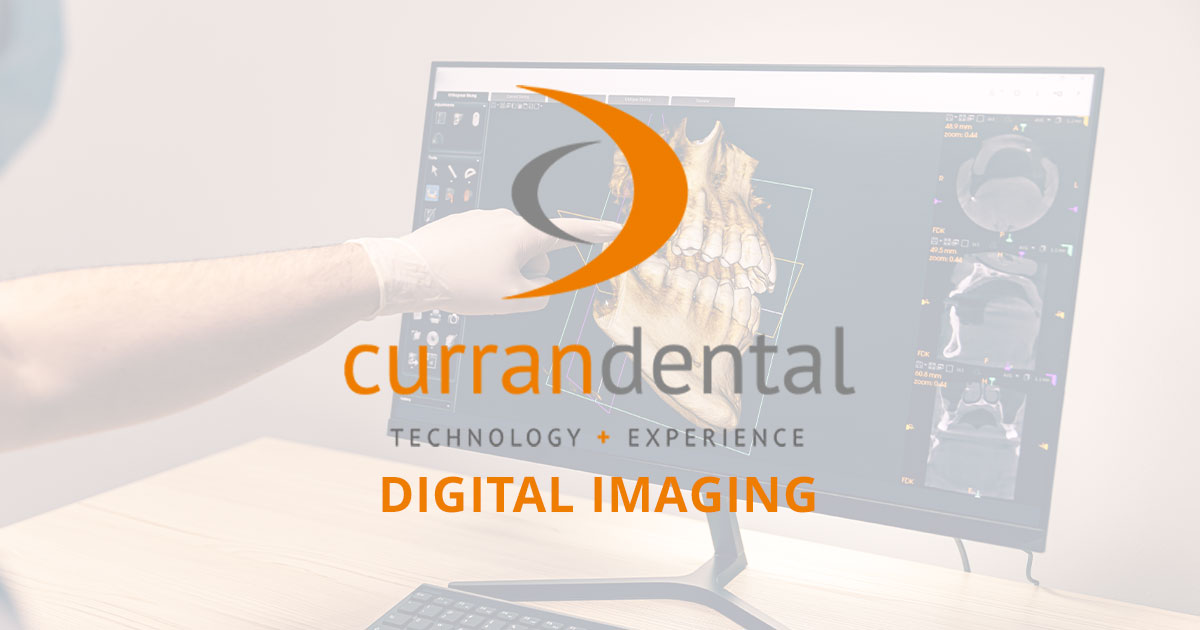 Digital Imaging | Dental Equipment | Curran Dental